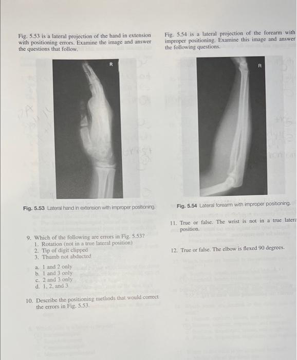 Solved Fig. 5.53 is a lateral projection of the hand in | Chegg.com