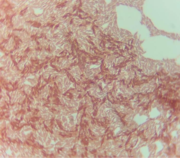 Solved is this a negative or positive endospore stain | Chegg.com