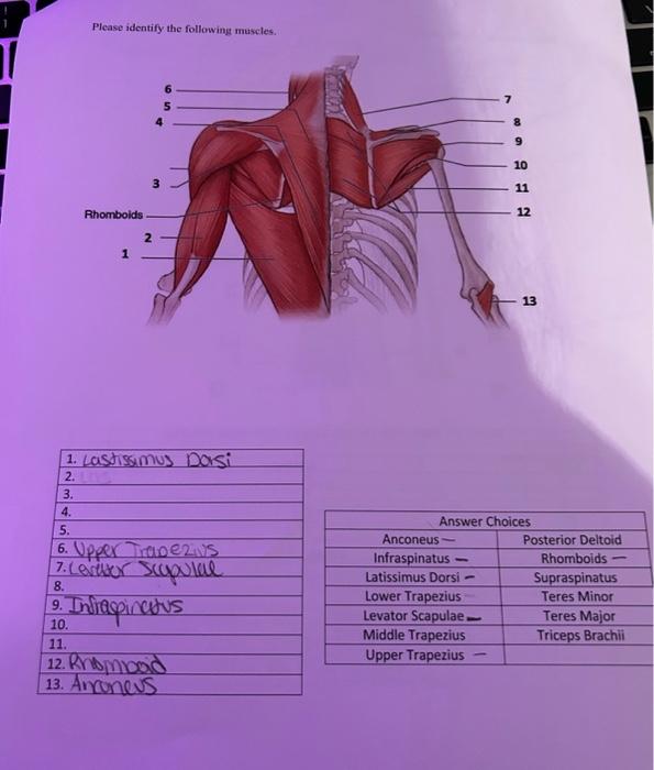 Solved Upper Extremity Anatomy (word banks under answer | Chegg.com