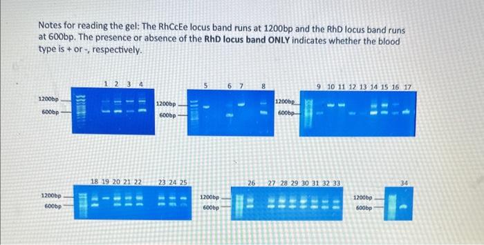 Solved Notes for reading the gel: The RhCcEe locus band runs | Chegg.com