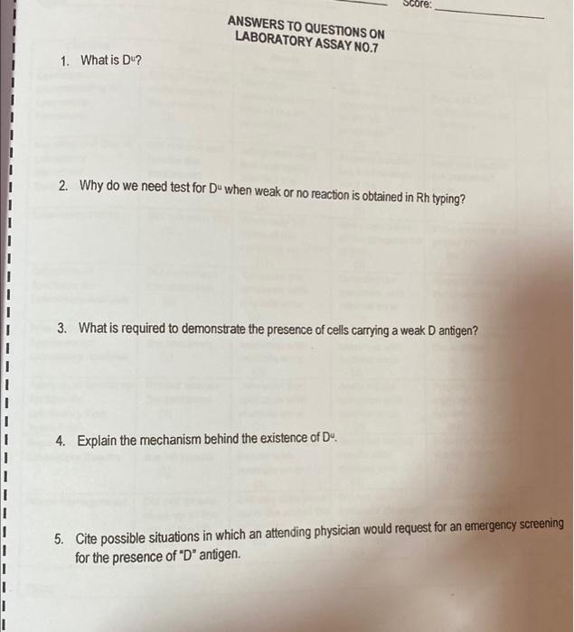 Solved 1. What is Du? 2. Why do we need test for Du when | Chegg.com