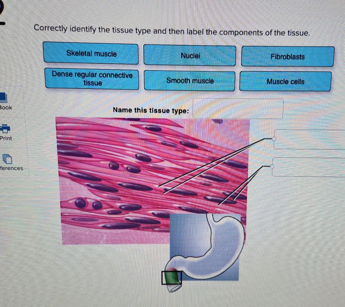 Solved Correctly identify the tissue type and then label the | Chegg.com