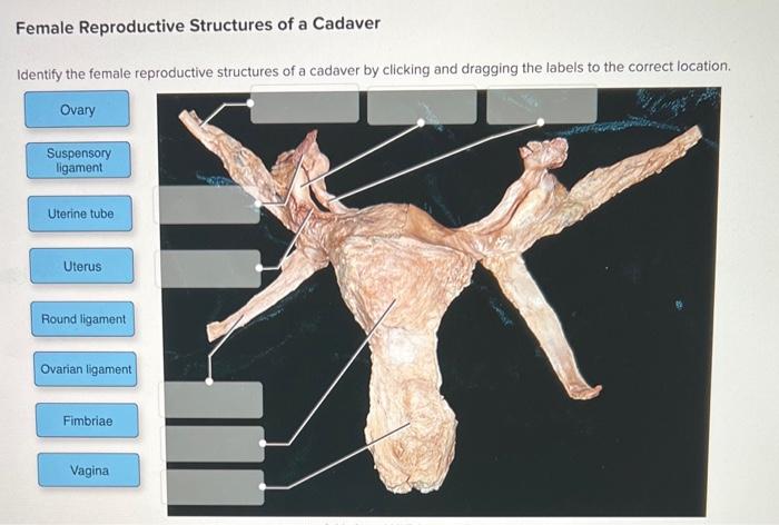 Solved Female Reproductive Structures of a Cadaver Identify | Chegg.com