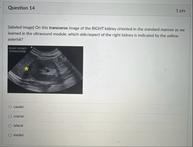 Solved Question 141 ﻿pts(labeled image) ﻿On this transverse | Chegg.com