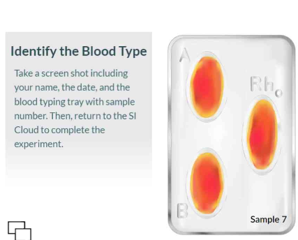 Solved Determine the blood type and explain your findings | Chegg.com