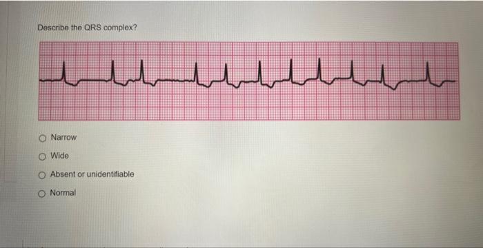 Solved Describe the QRS complex? Narrow Wide Absent or | Chegg.com