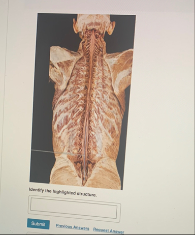 Solved Identify the highlighted structure. Previous | Chegg.com