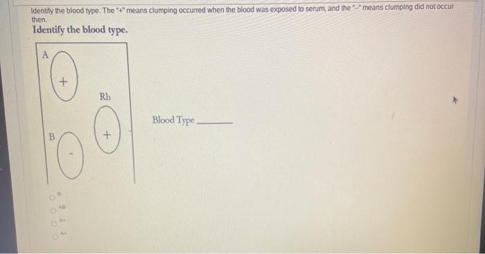 Solved Identify the blood type. The "+" means clumping | Chegg.com