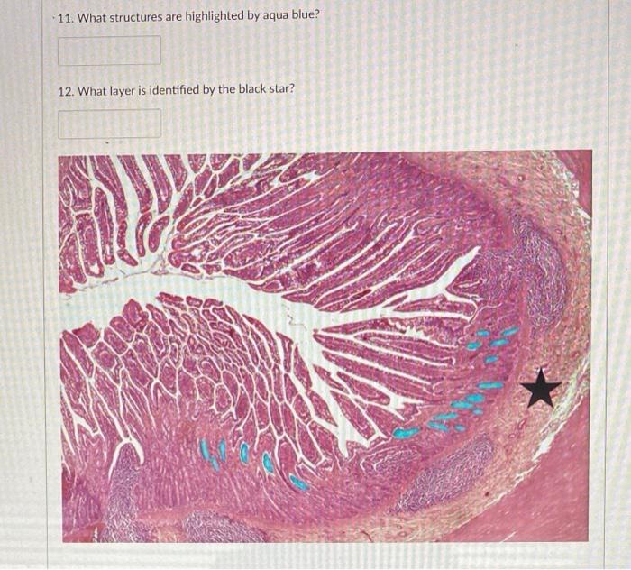 Solved 11. What structures are highlighted by aqua blue? 12. | Chegg.com