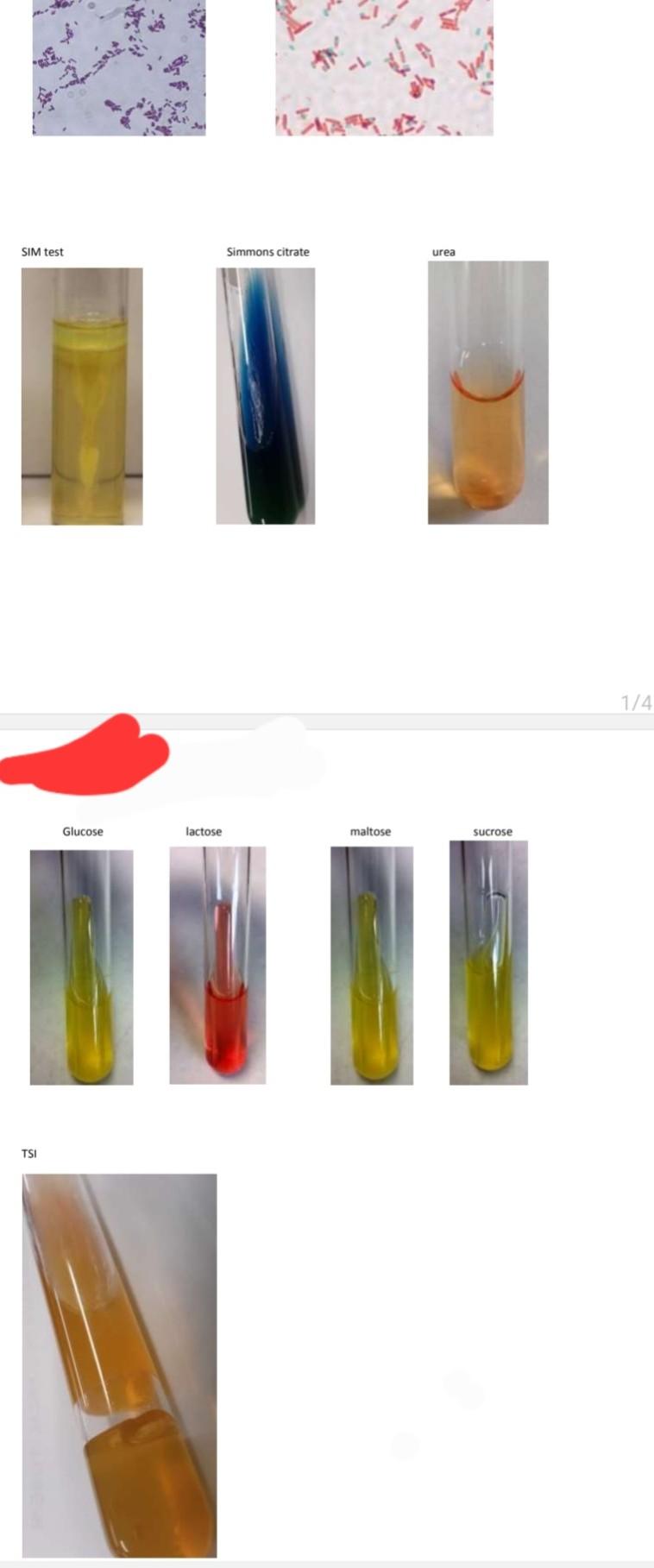 Solved ya SIM test Simmons citrate urea 1/4 Glucose lactose | Chegg.com