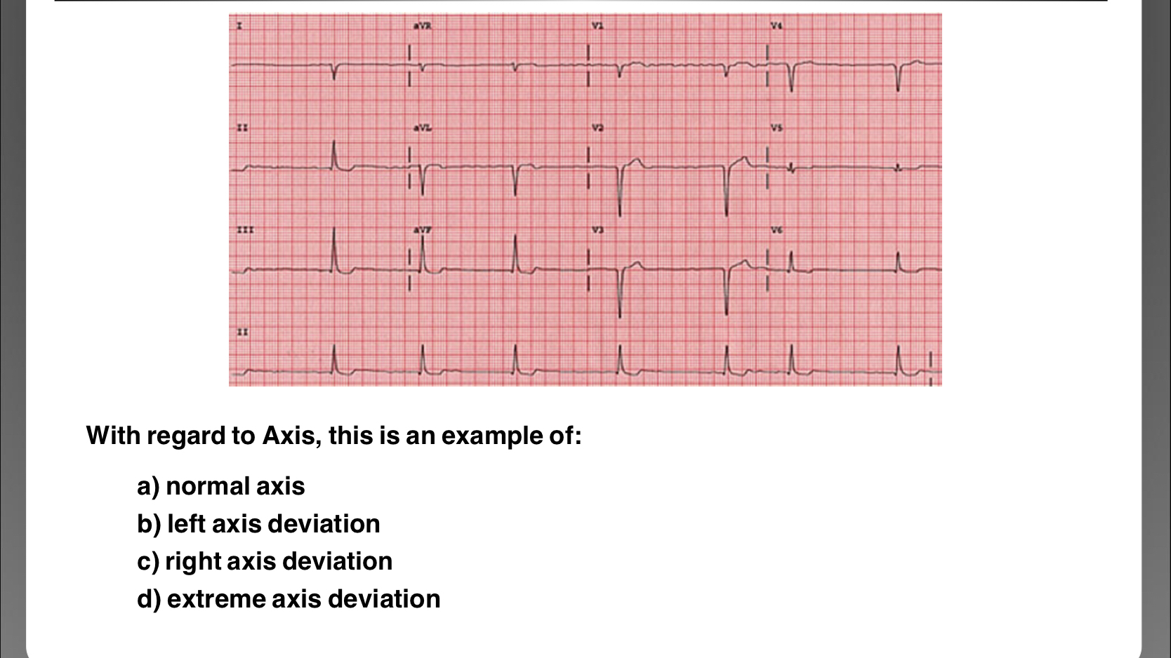Solved With regard to Axis, this is an example of:a) ﻿normal | Chegg.com