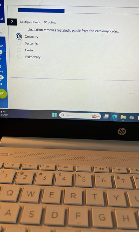 Solved 2Multiple Choice10 ﻿points ﻿circulation removes | Chegg.com