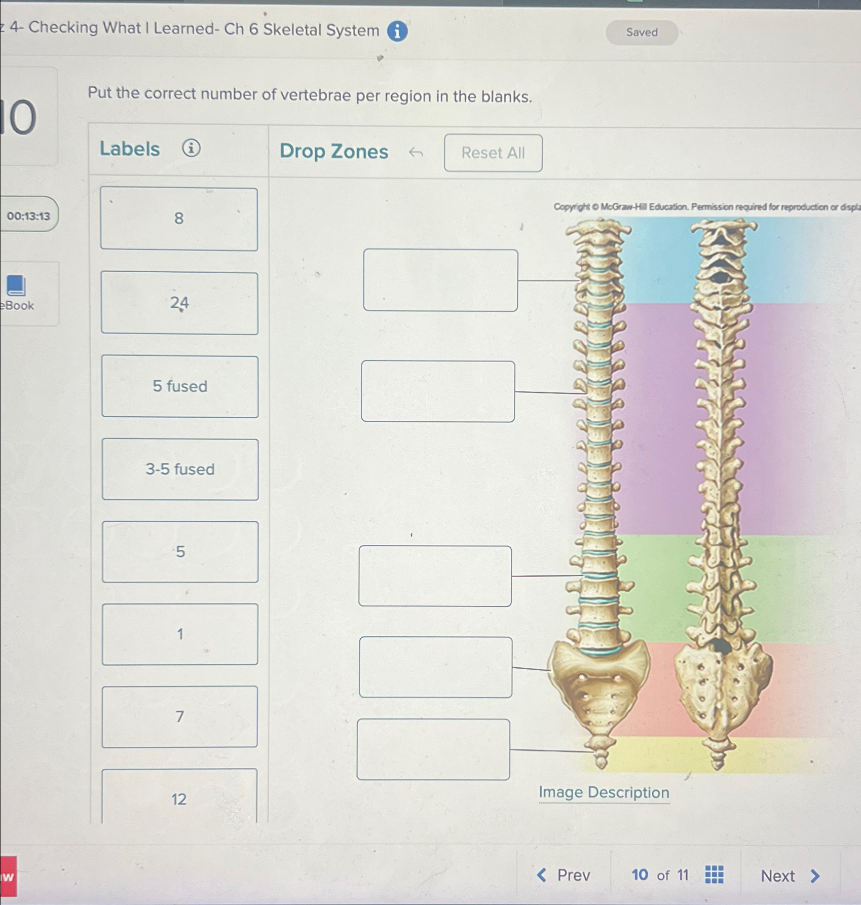 Solved 4- ﻿Checking What I Learned- ﻿Ch 6 ﻿Skeletal | Chegg.com