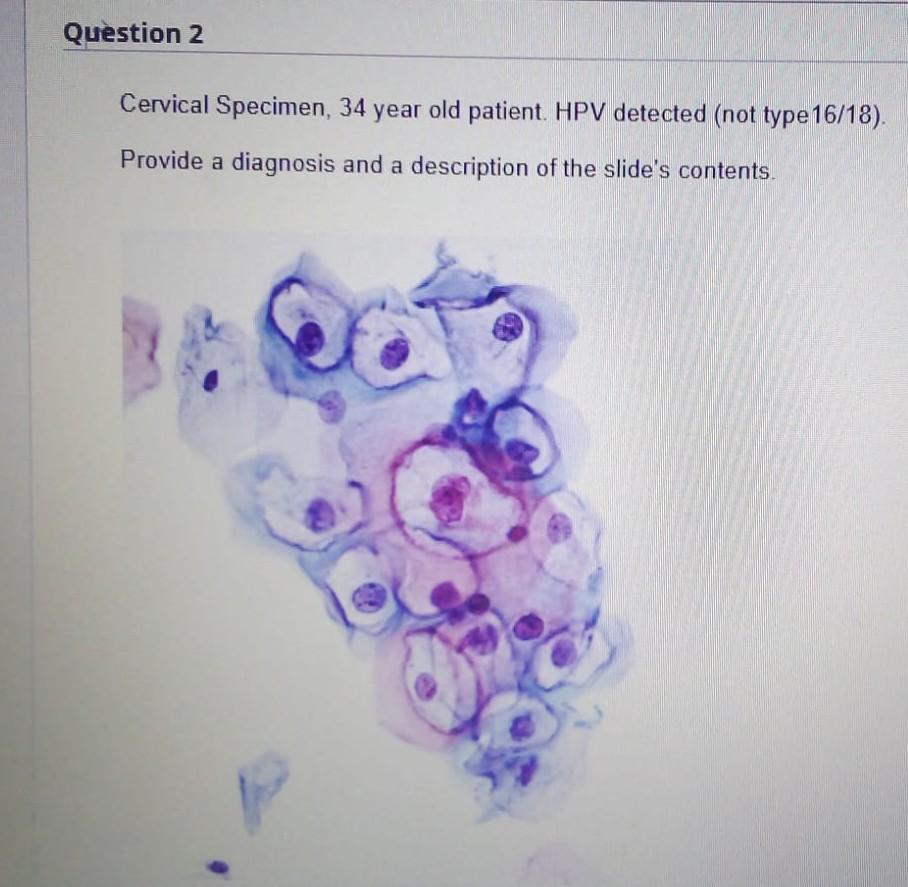 Cervical Specimen, 34 year old patient. HPV detected | Chegg.com