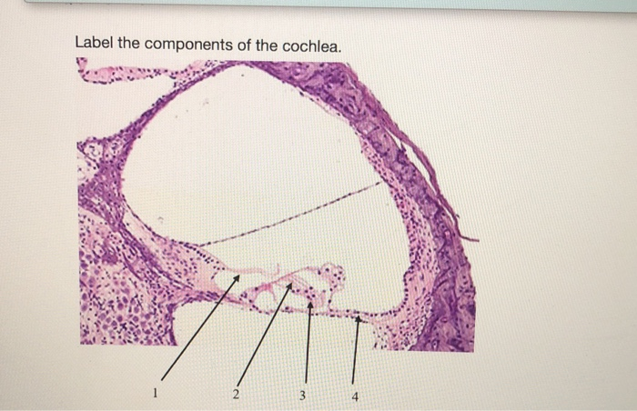 Solved Label the components of the cochlea. 2 3 | Chegg.com