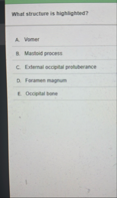Solved What structure is highlighted?A. ﻿VomerB. ﻿Mastoid | Chegg.com