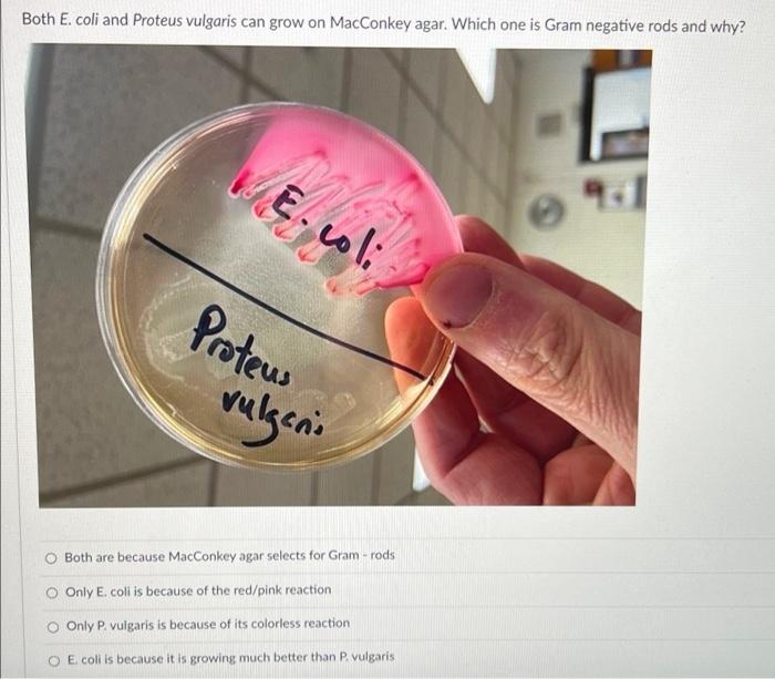 Proteus Mirabilis On Macconkey Agar