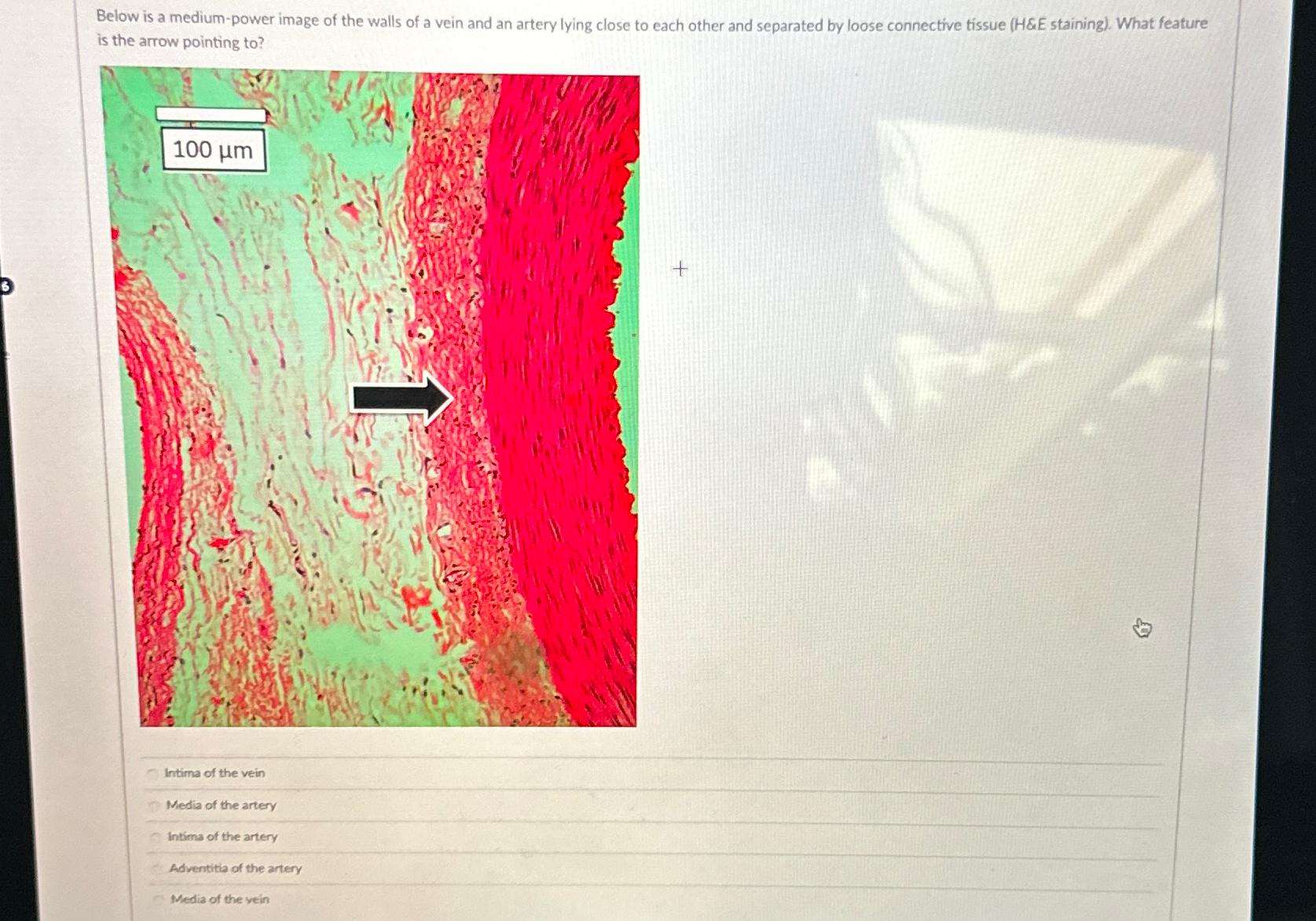 Solved Below is a medium-power image of the walls of a vein | Chegg.com