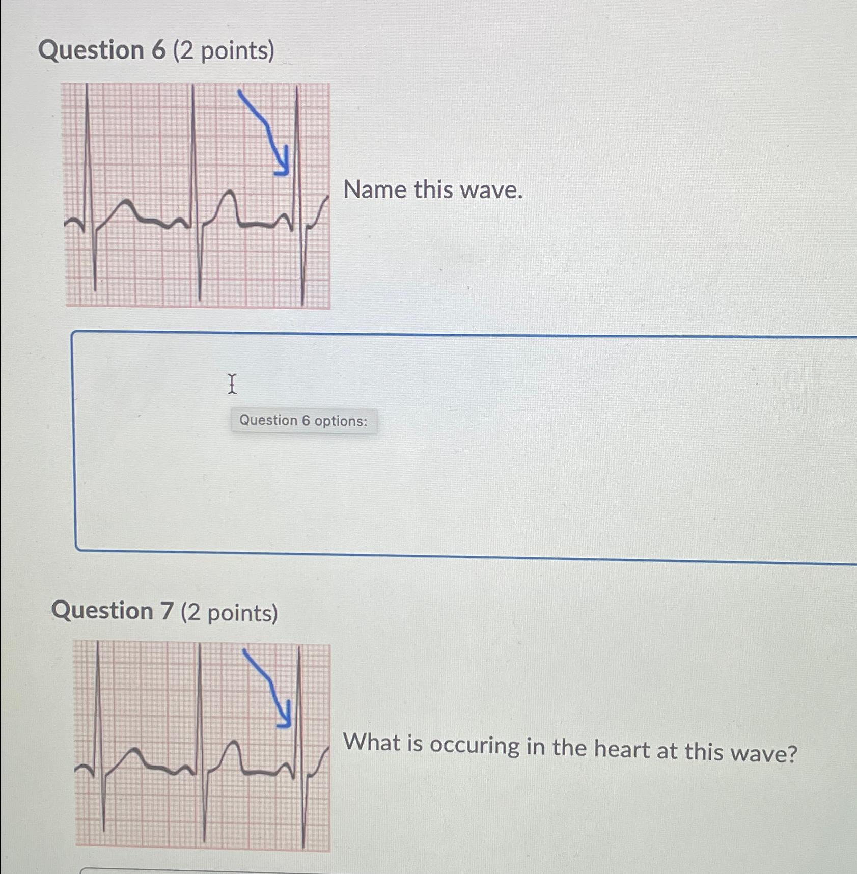 Solved Question 6 (2 ﻿points)Name this wave.Question 7 (2 | Chegg.com