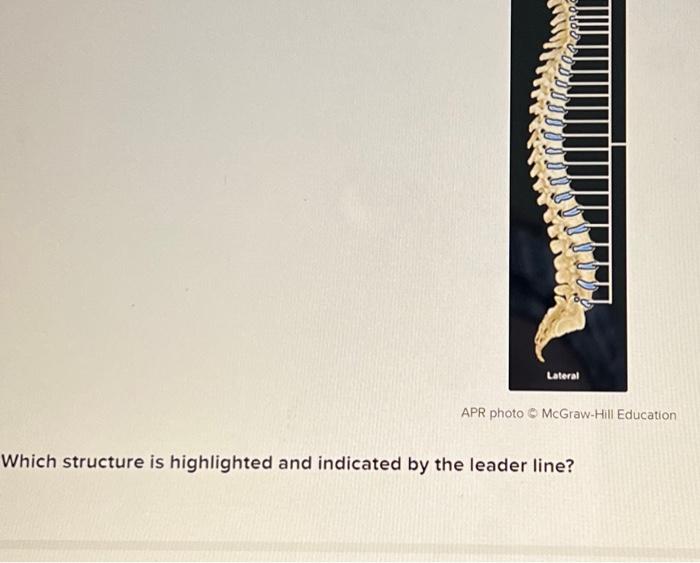 Solved a. spinous processes b. vertebra prominens (C7) c. | Chegg.com