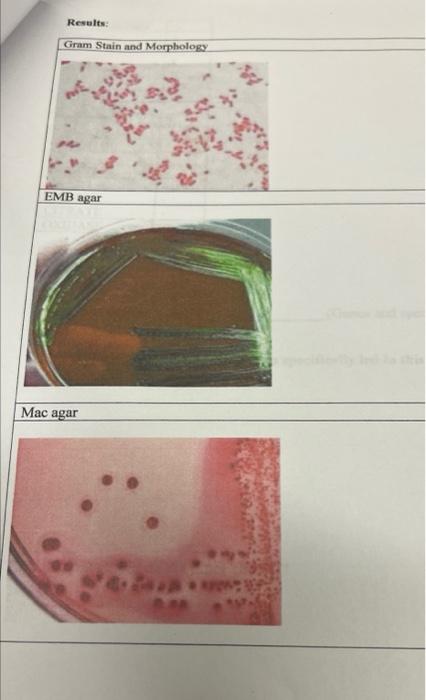 Solved Virtual Gram Negative Unknown Lab cuon Unknown Letter | Chegg.com Solved Virtual Gram Negative Unknown Lab cuon Unknown Letter | Chegg.com