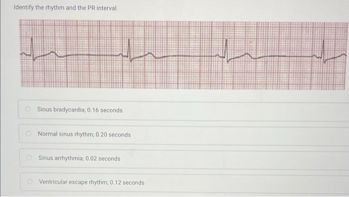 Solved Identify the rhythm and the PR interval, Sinus | Chegg.com