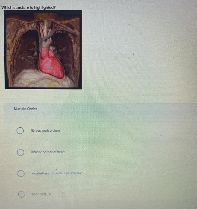 Solved Which structure is highlighted? Multiple Choice | Chegg.com