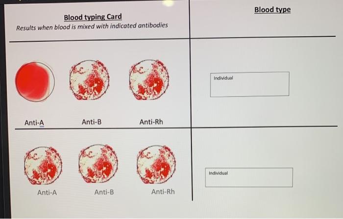 Solved Blood type Blood typing Card Results when blood is | Chegg.com