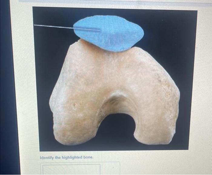 Solved Identify the highlighted bone. | Chegg.com