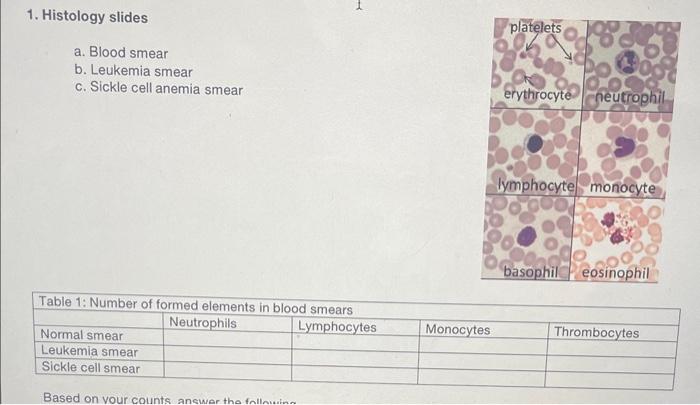 Solved 1. Histology slides a. Blood smear b. Leukemia smear | Chegg.com
