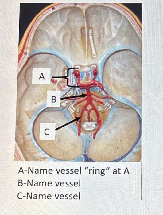 Solved A-Name vessel "ring" at A B-Name vessel C-Name vessel | Chegg.com