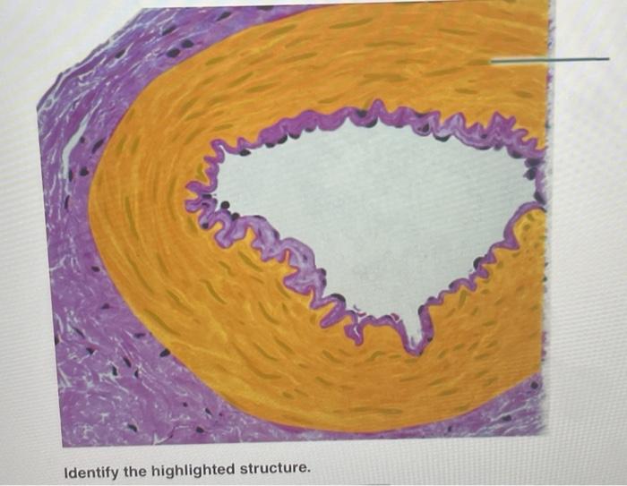 Solved ម Identify the highlighted structure. | Chegg.com