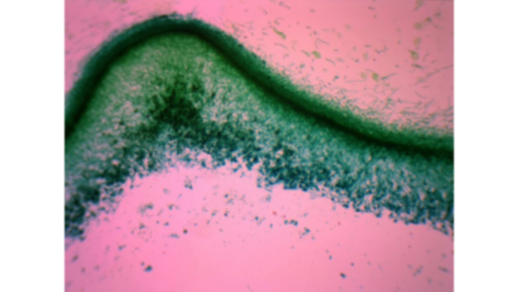Solved Lable the hypha conidiophore and conidium | Chegg.com