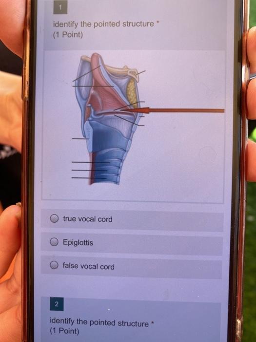 Solved identify the pointed structure (1 Point) true vocal | Chegg.com