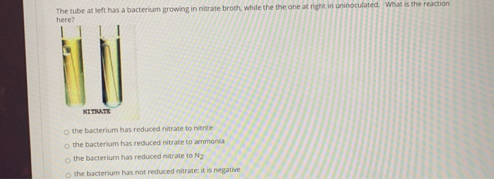 Solved QUESTION 33 The reagent, added after incubation, to | Chegg.com