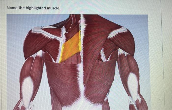 Solved Name the highlighted muscle. Name the highlighted | Chegg.com