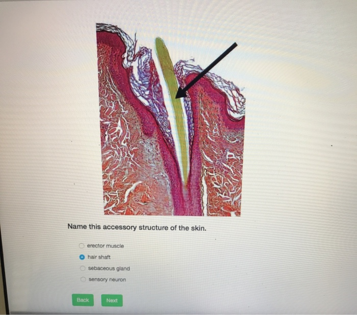 Solved Name this accessory structure of the skin. erector | Chegg.com