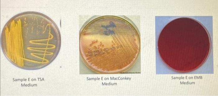 Solved M. luteus B. cereus S. epidermidis E. coli A. | Chegg.com