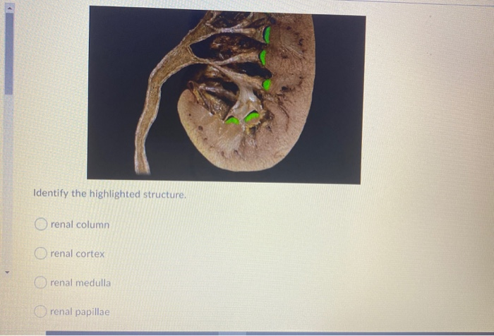 Solved Identify the highlighted structure. Identify the | Chegg.com