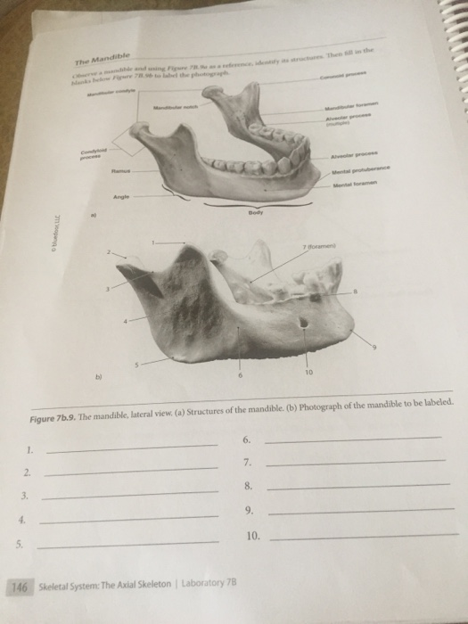 Solved The Mandible to, Figure 7.9. The mandible, lateral | Chegg.com