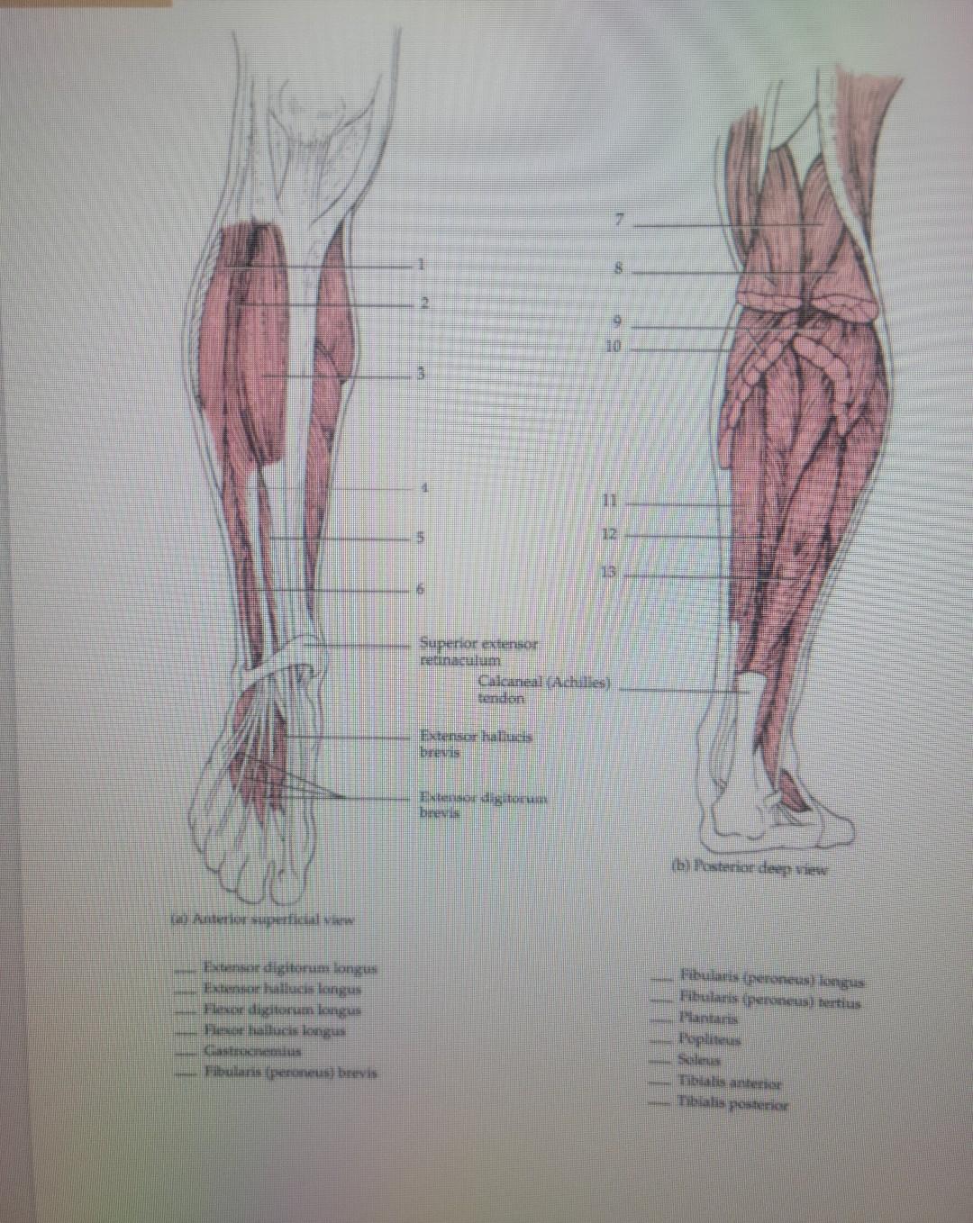 Solved 5. 3 5 Superior extensor retinaculum Calcaneal | Chegg.com
