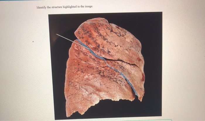 Solved Identify the structure highlighted in the image. Be | Chegg.com