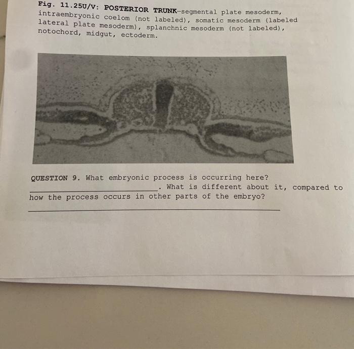 Solved Fig. 11.250/V: POSTERIOR TRUNK-segmental plate | Chegg.com