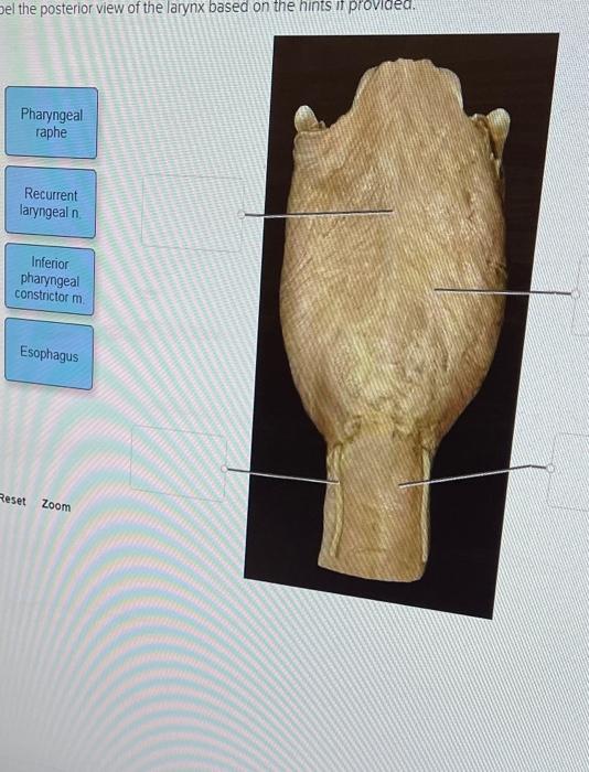 Solved Del the posterior view of the larynx based on the | Chegg.com