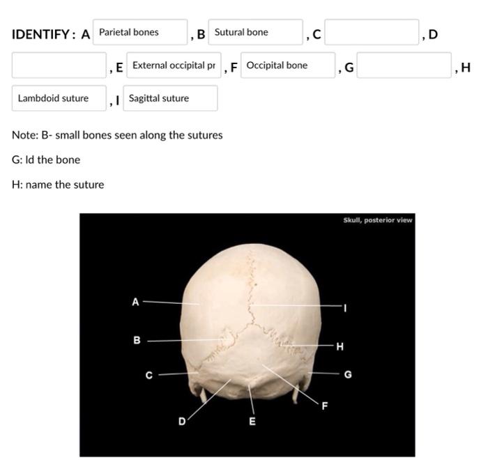 Solved IDENTIFY: A Parietal bones B Sutural bone ,C ,D E | Chegg.com