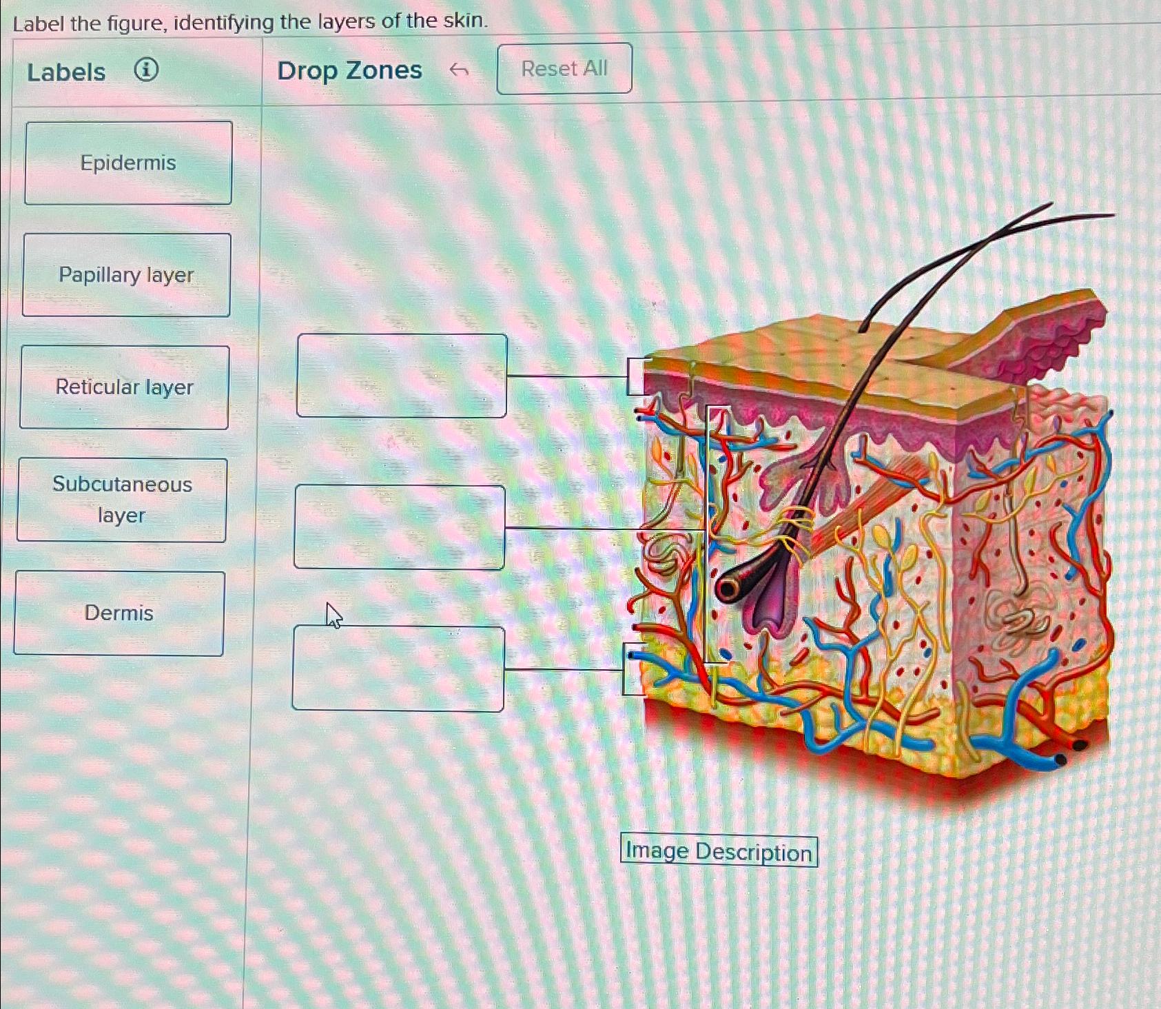 Solved Label the figure, identifying the layers of the skin. | Chegg.com