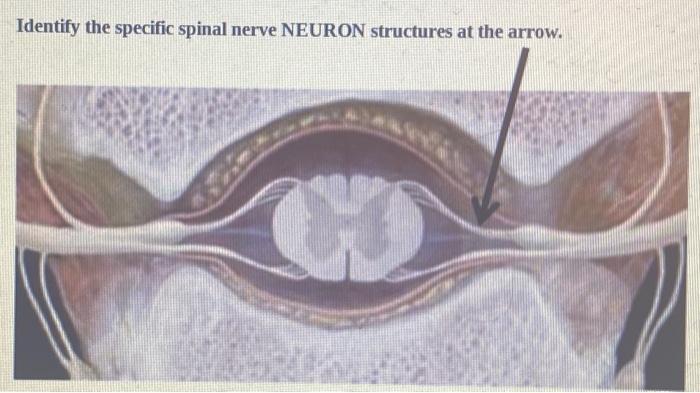 Solved Identify the specific spinal nerve NEURON structures | Chegg.com