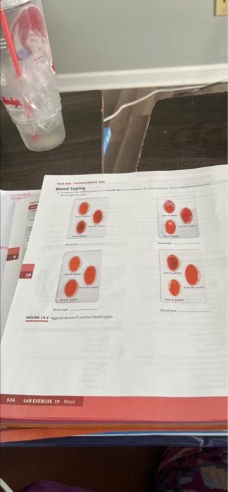 ore less. cles. Wendy's. fec Somatic extin 9 TABLE | Chegg.com