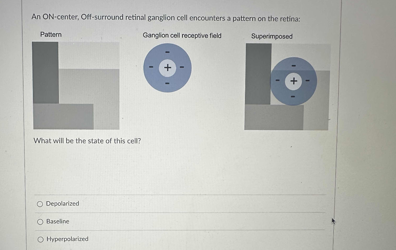 An ON-center, Off-surround retinal ganglion cell | Chegg.com