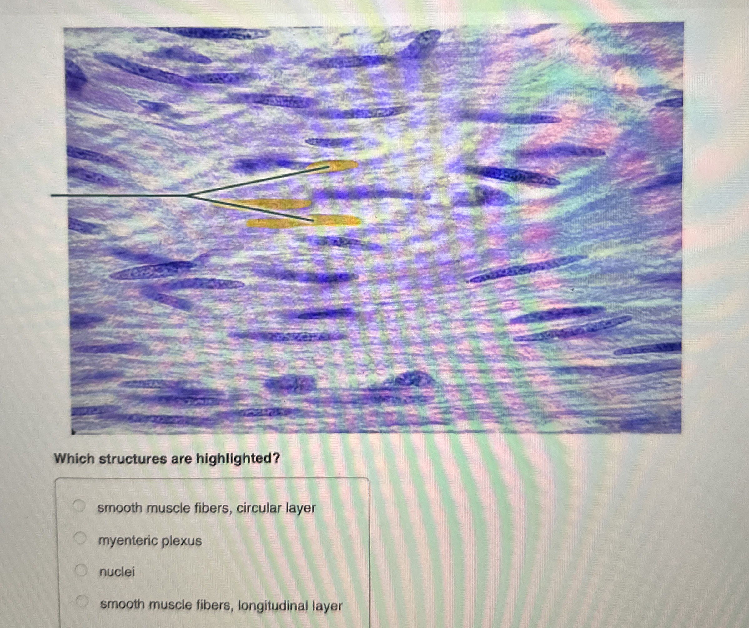 Solved Which structures are highlighted?smooth muscle | Chegg.com